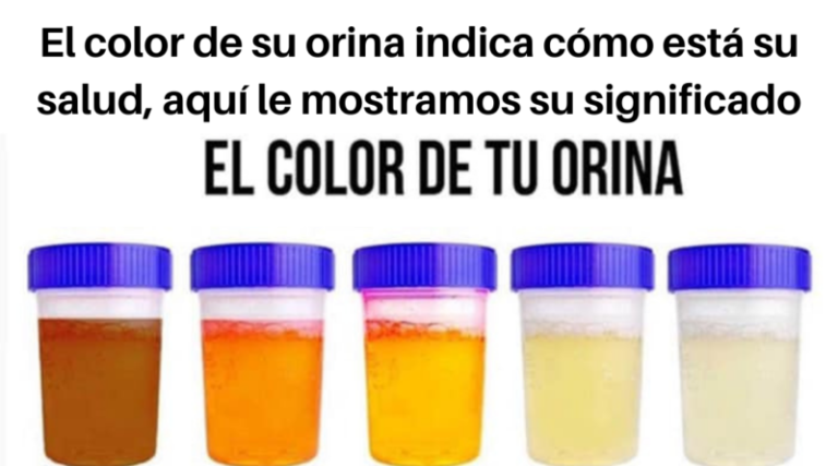 El color de su orina indica cómo está su salud, aquí le mostramos su ...